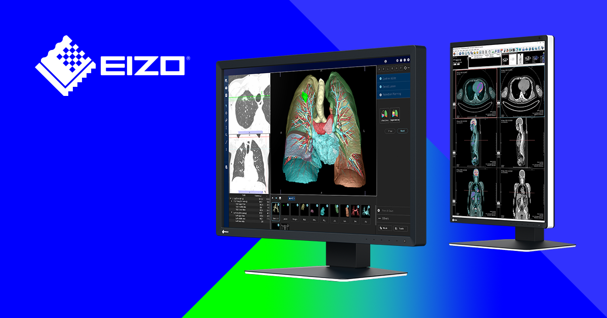 Referenzen | Medizinische Monitore von EIZO