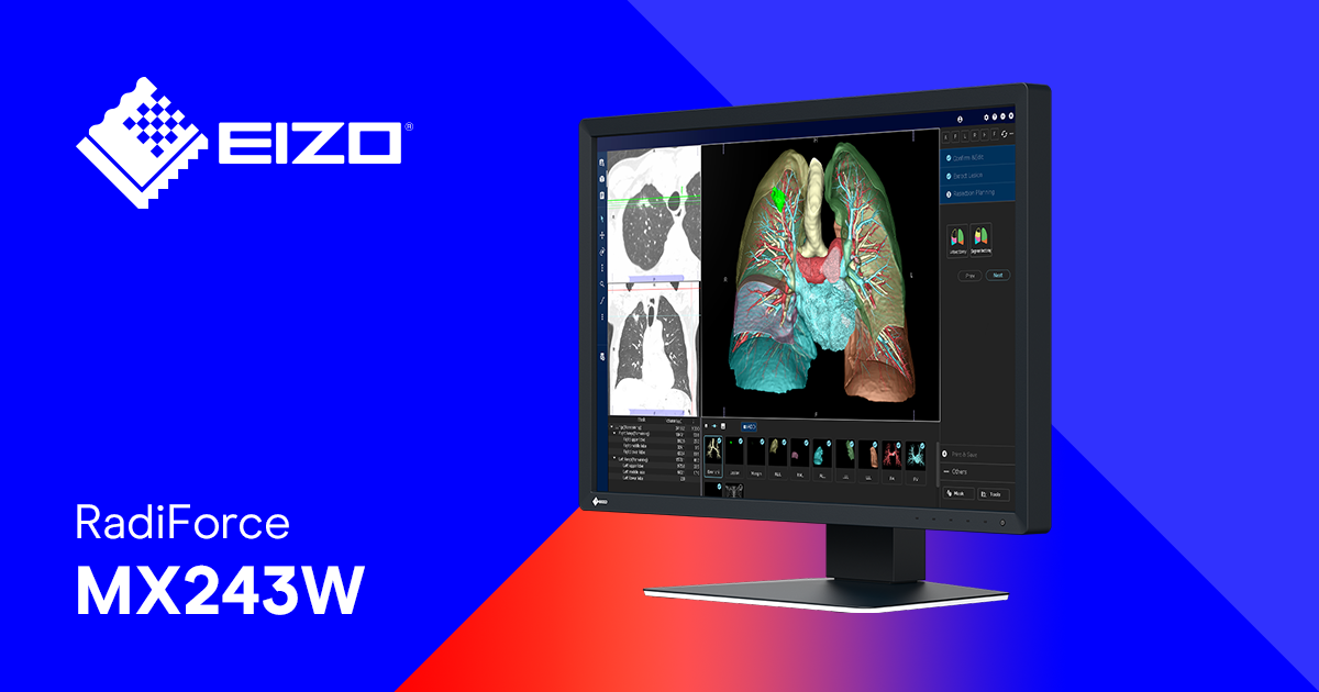 RadiForce MX243W | 24“-DICOM-PreSet-Monitor mit 2,3 MP